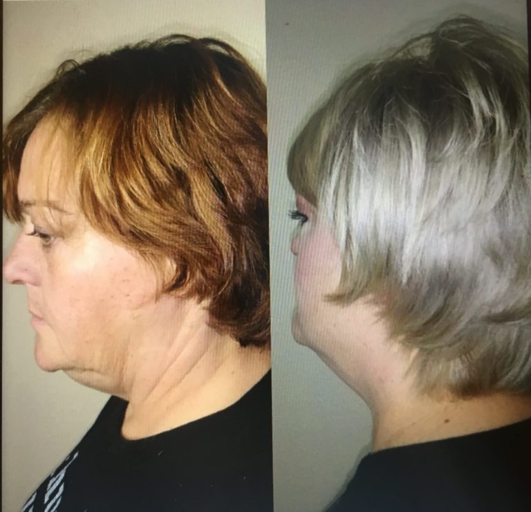 Growing out Gray-cefully