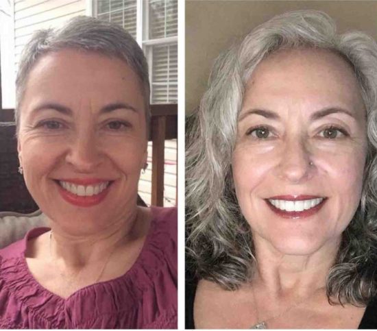 Growing out Gray-cefully